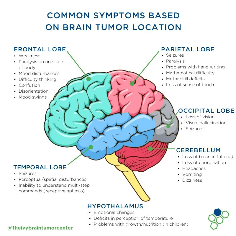 Brain Tumor Causes Brain Tumor Causes