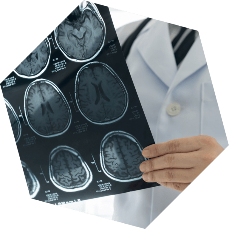 Neuroimaging | Ivy Brain Tumor Center